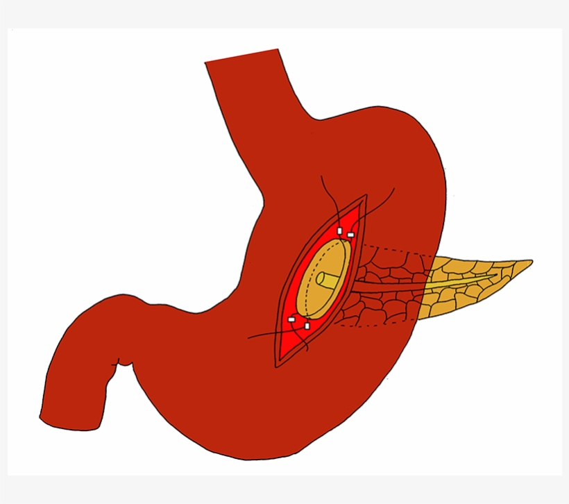 References PNG Image | Transparent PNG Free Download on SeekPNG