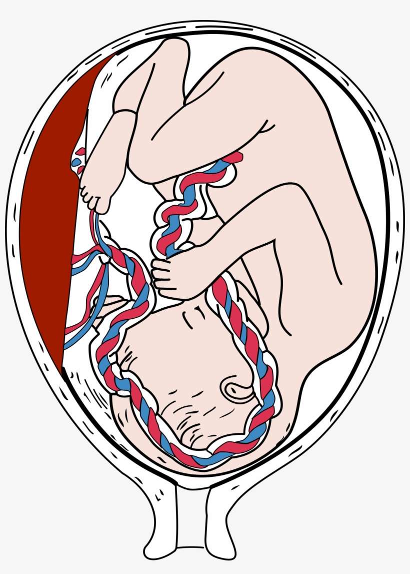This Free Icons Png Design Of Placenta And Fetus PNG Image ...