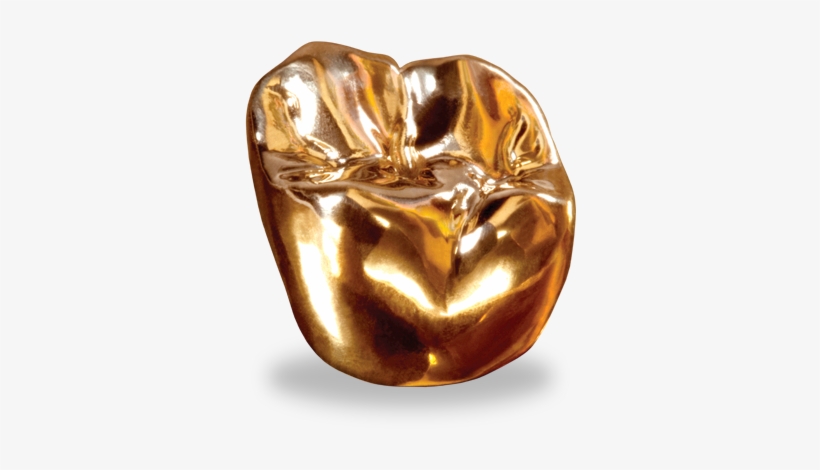 Full Cast Gold Restorations - Pfm Crown Metal Occlusal PNG Image ...