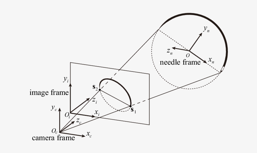 Notations Of Camera Frame Fc, Image Frame F I And Needle - Triangle PNG ...