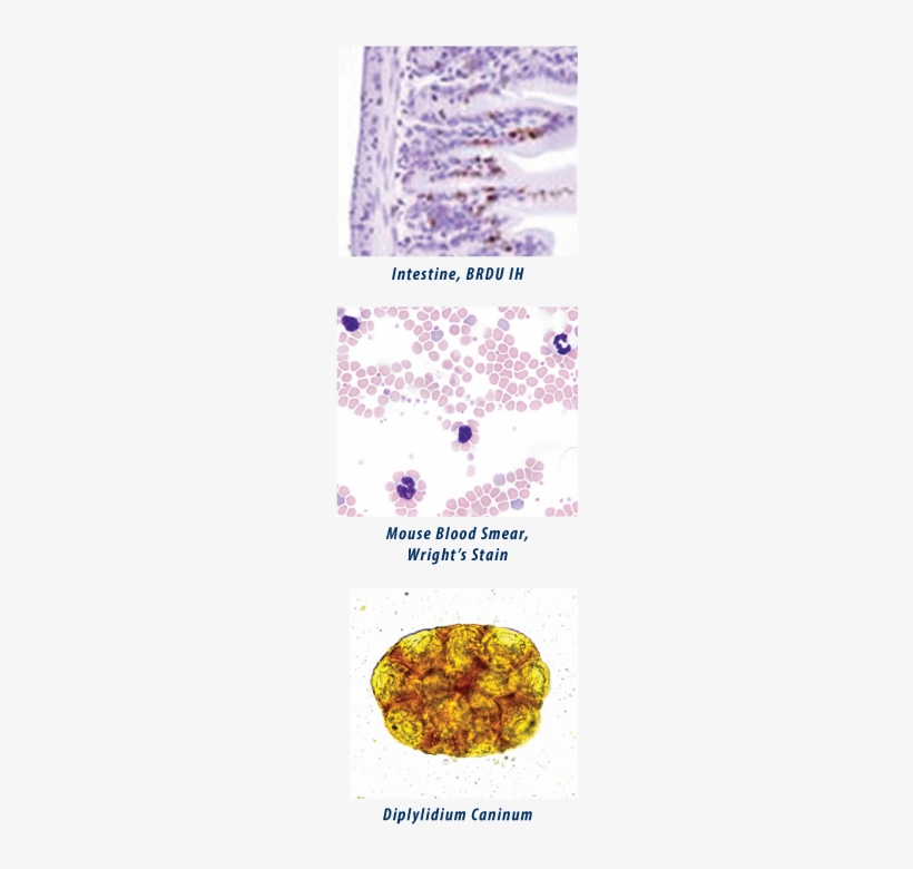 Microscopic Images From Ivac Pathology - Microscope PNG Image ...