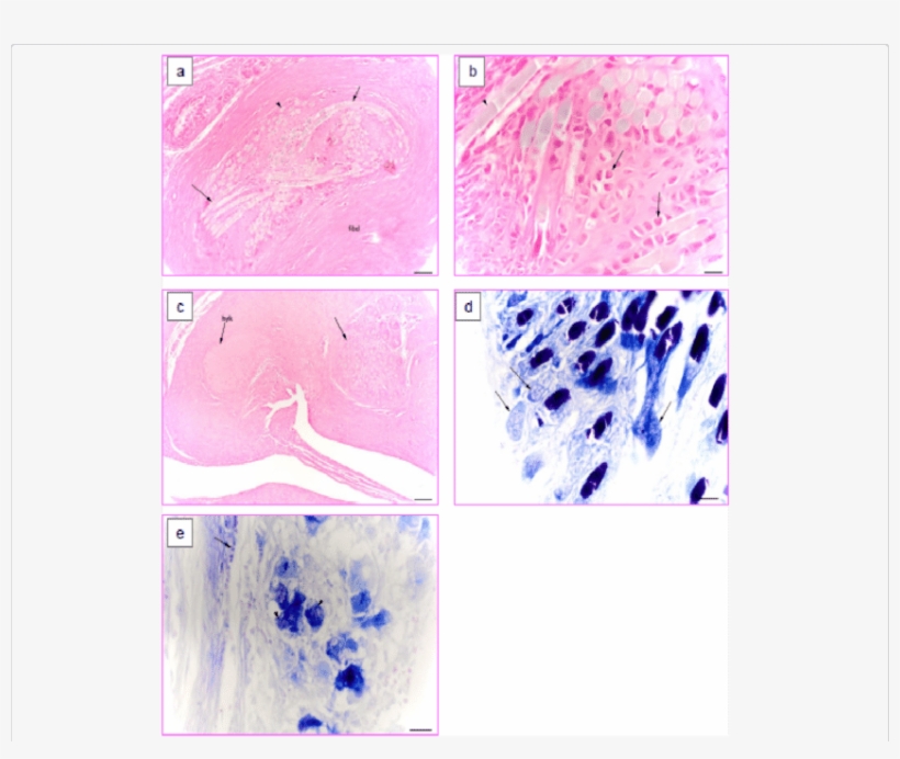 Download In The Long Axis (arrows) And Cross Section (arrowhead) - Cell ...
