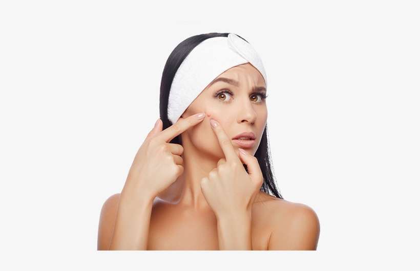 How To Fight Acne - Blackhead Spot Removal Tweezer Facial Pimple ...