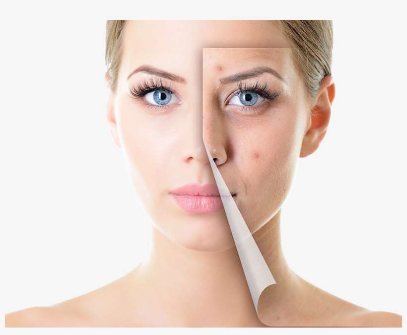 Acne Out Soap With Lactic And Salicylic Acid PNG Image | Transparent ...