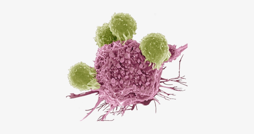 Download T-cells Attacking A Cancer Cell - Sem Of B Lymphocyte ...
