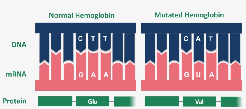 Point Mutation Sickle Cell Normal And Mutated Hemoglobin - Mutated ...