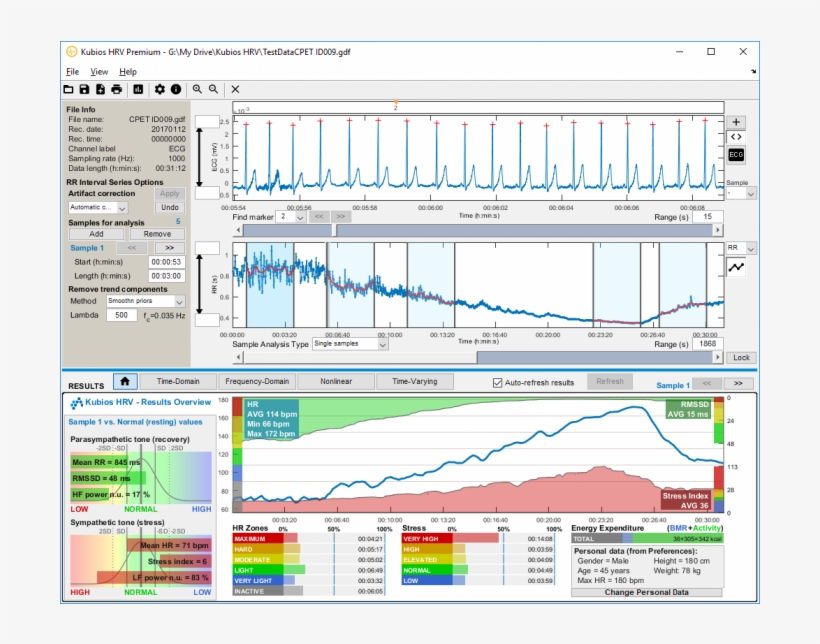 Heart Rate Variability PNG Image | Transparent PNG Free Download on SeekPNG
