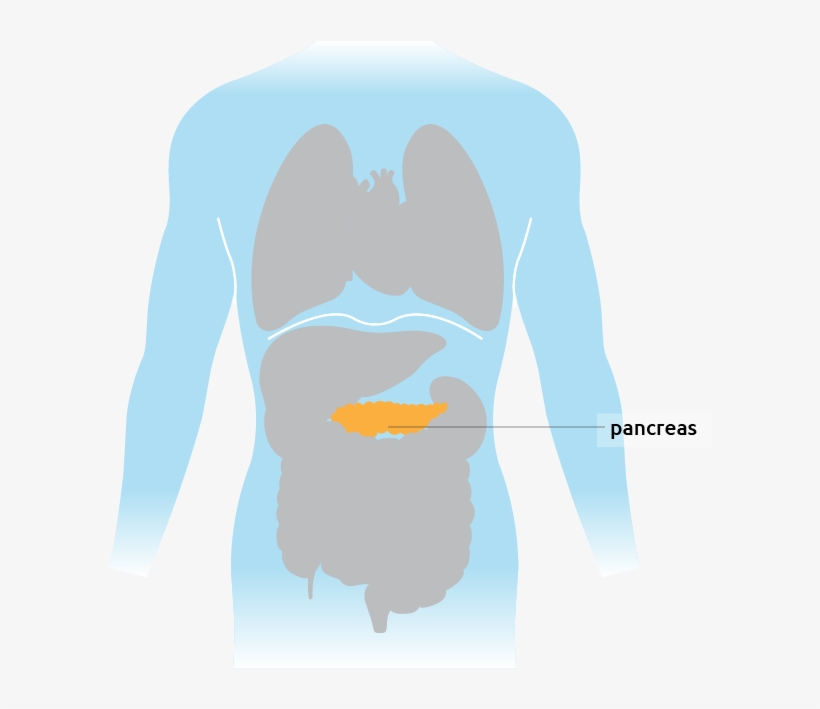 The Pancreas Situated In The Torso - Pancreas Transplantation PNG Image ...