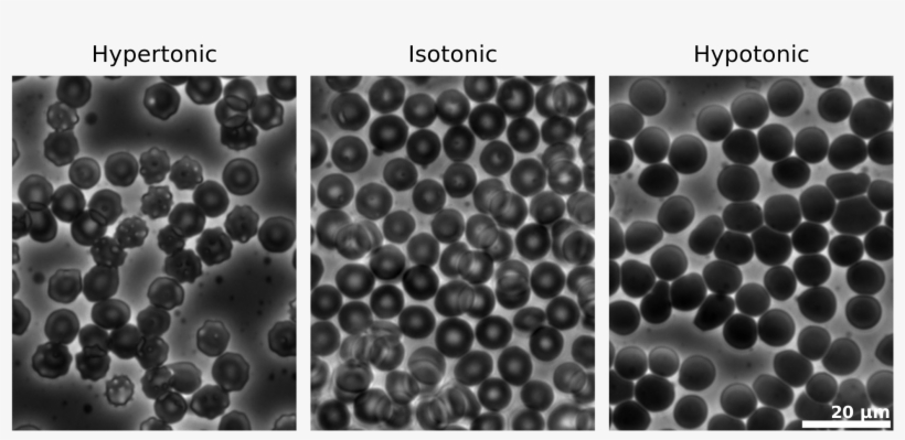 Open - Hypotonic Solution Under Microscope PNG Image | Transparent PNG ...