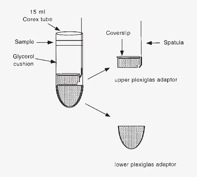 Drawings Showing The Setup For Spinning Down Spindle - Drawing PNG ...
