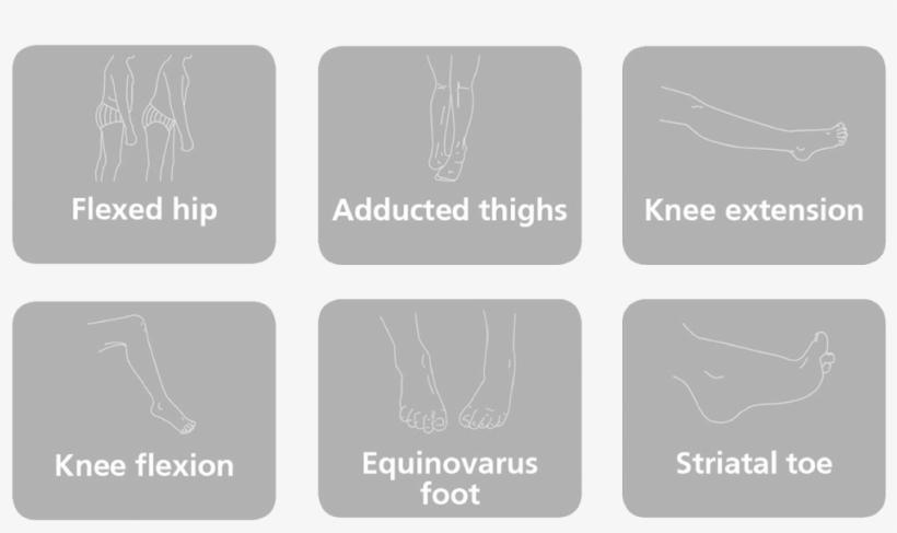 Striatal Toe - Graphic Design PNG Image | Transparent PNG Free Download ...