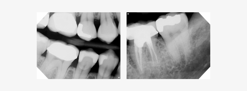 Digital Xray - Digital Radiography PNG Image | Transparent PNG Free ...