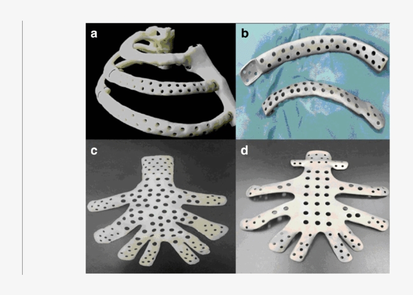 A, C Chest Reference Models For Cases 1 And 2, Respectively - 3d ...