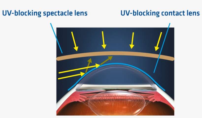 Sunglasses Plus Uv-blocking Contact Lenses - Uv Blocking Contact Lenses ...