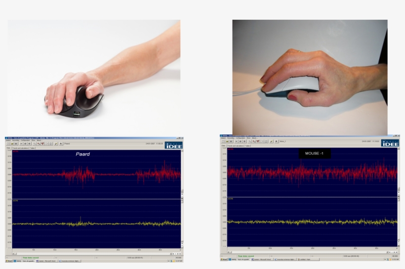 Download Emg Measurements - Emg In Ergonomics Mouse | Transparent PNG ...