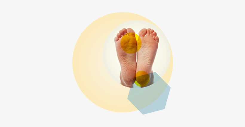 Soft Corns Form Between The Toes, And Stay Soft Due - Corn PNG Image ...