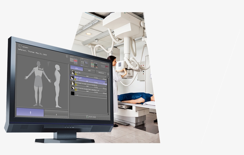 X Ray Acquisitionsoftware - Led-backlit Lcd Display PNG Image ...