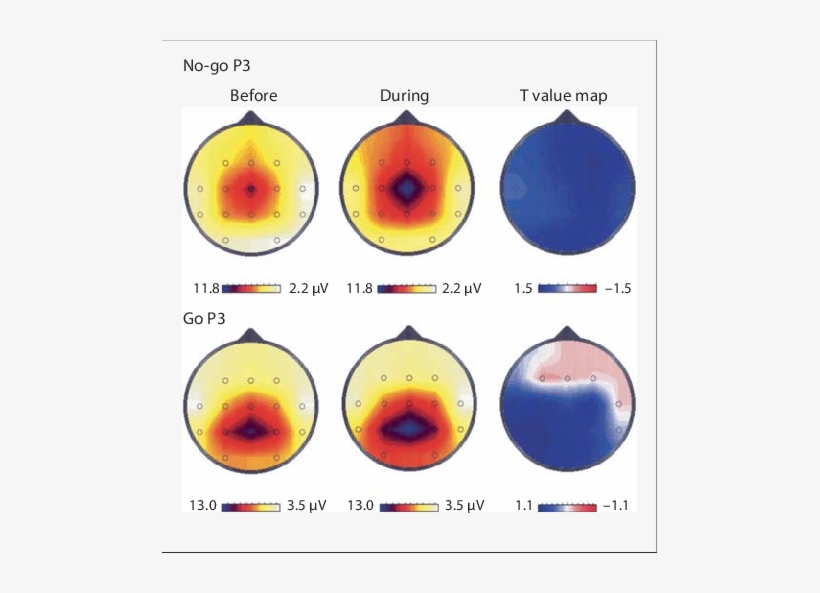 Comparison Of Go And No-go P3 Tm Before And During - Science PNG Image ...