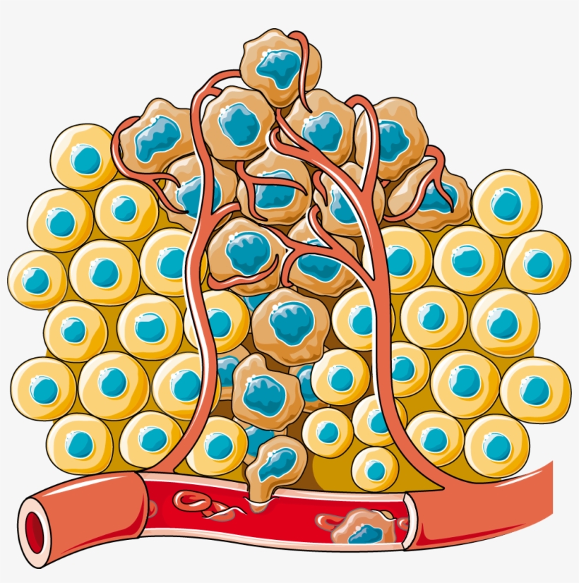 Cancer Dissemination - Vector Cancer Cell PNG Image | Transparent PNG ...
