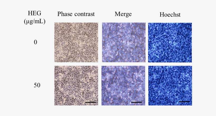 Effect Of Heg On Apoptosis In Hepg2 Cells - Nse:heg PNG Image ...