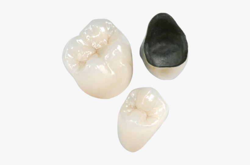 Composite Material PNG Image | Transparent PNG Free Download on SeekPNG