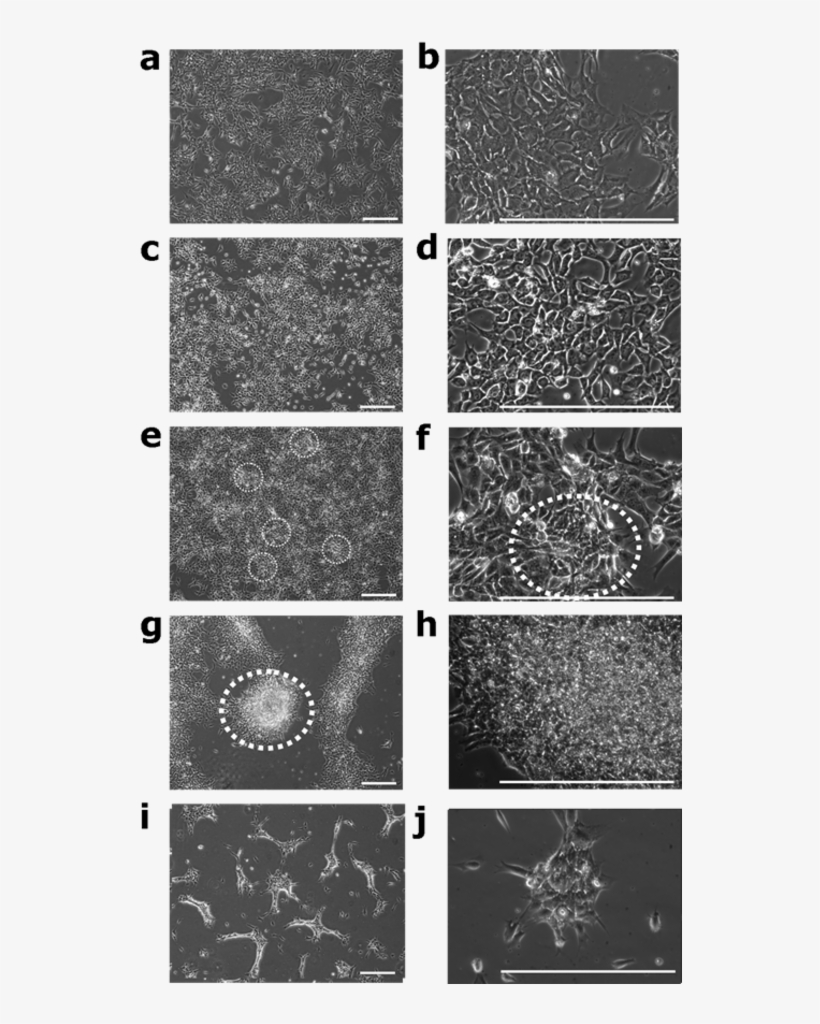 Figure - Transmission Electron Microscopy PNG Image | Transparent PNG ...
