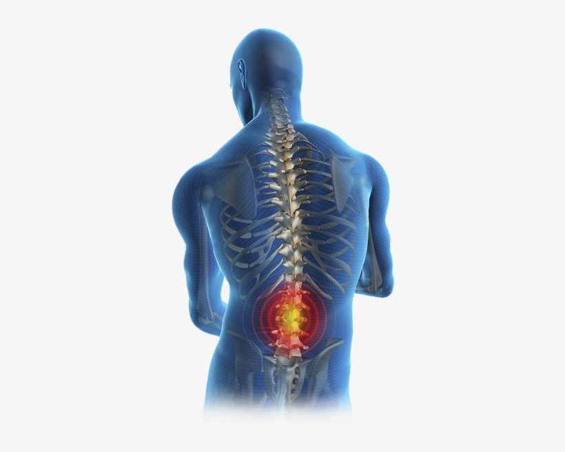 Lower Back Pain PNG Image | Transparent PNG Free Download on SeekPNG