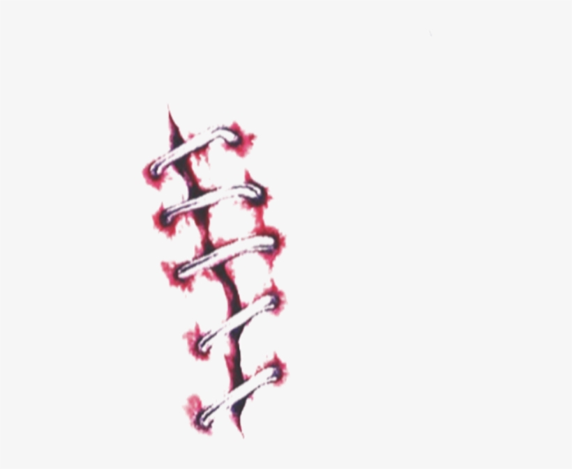 Stitches Png