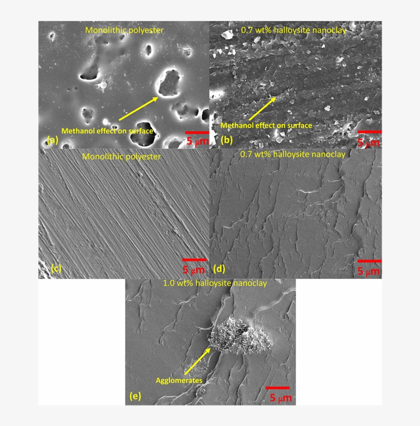 Sem Images Of Fractured Surface - Bone Fracture PNG Image | Transparent ...
