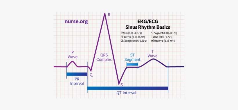Download Normal Ecg Graph - Plot | Transparent PNG Download | SeekPNG