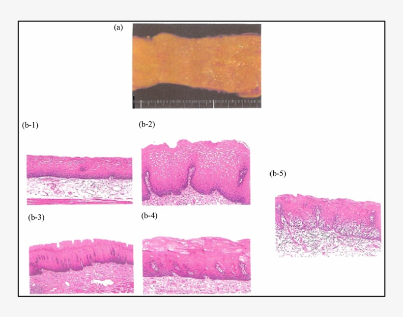 Macroscopic View And Histology (b) Of Human Esophageal - Pattern PNG ...