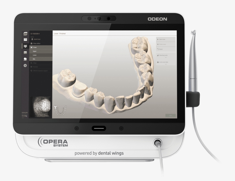 Dental Wings Portable Intraoral Scanner PNG Image | Transparent PNG ...