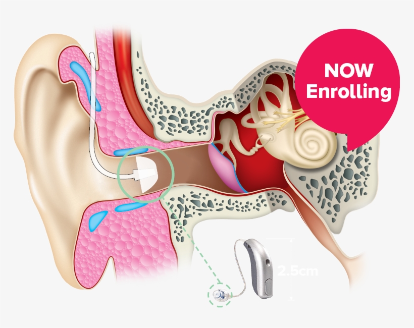 Ear Anatomy Diagram PNG Image | Transparent PNG Free Download on SeekPNG