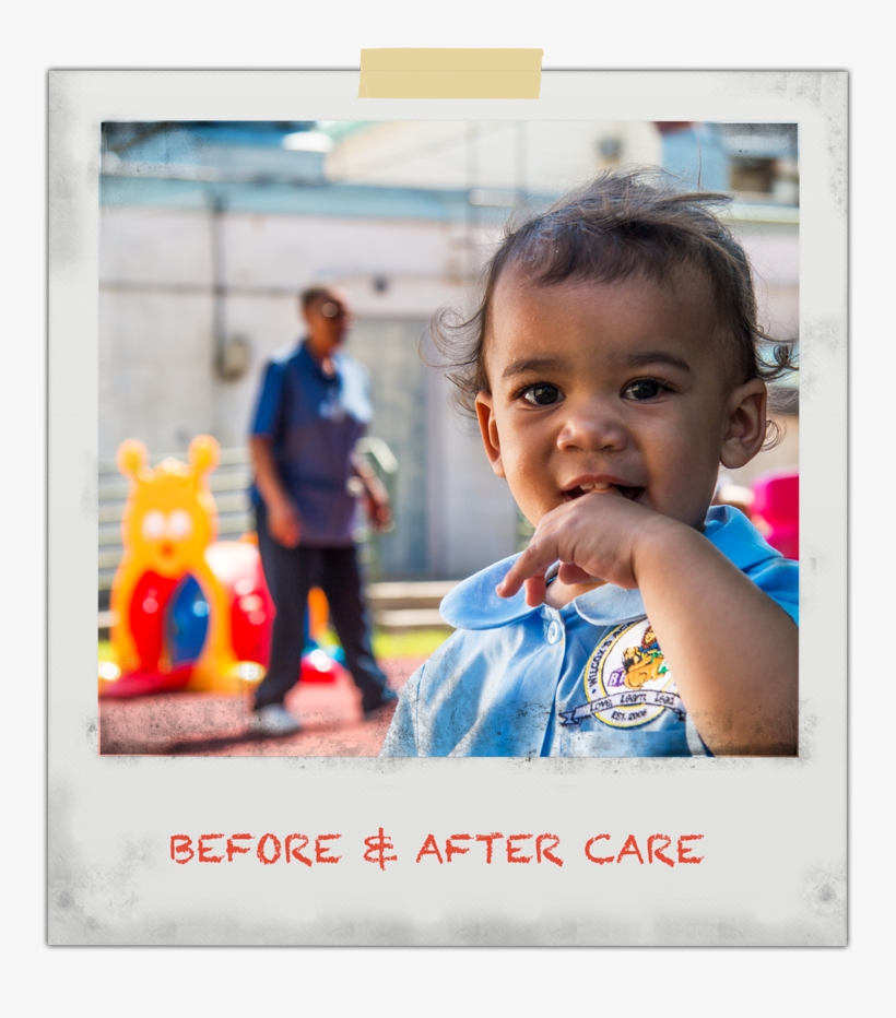 Wael Before After Care Img PNG Image | Transparent PNG Free Download on ...