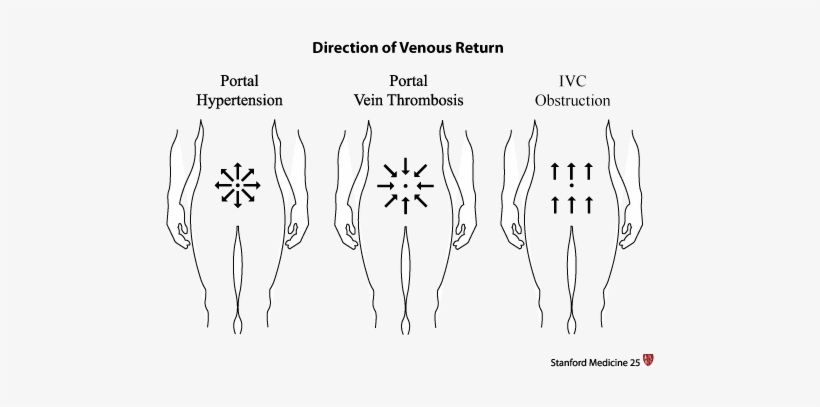 Abdominal Venous Patterns - Portal Hypertension Vs Ivc Obstruction PNG ...