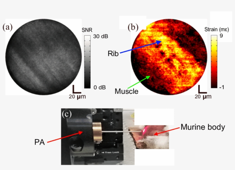 En Face Ocm Image And (b) Strain Micro-elastogram At PNG Image ...