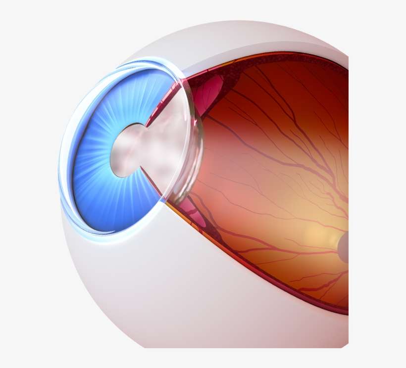 Diagram Of An Eye With Cataracts - Sphere PNG Image | Transparent PNG ...