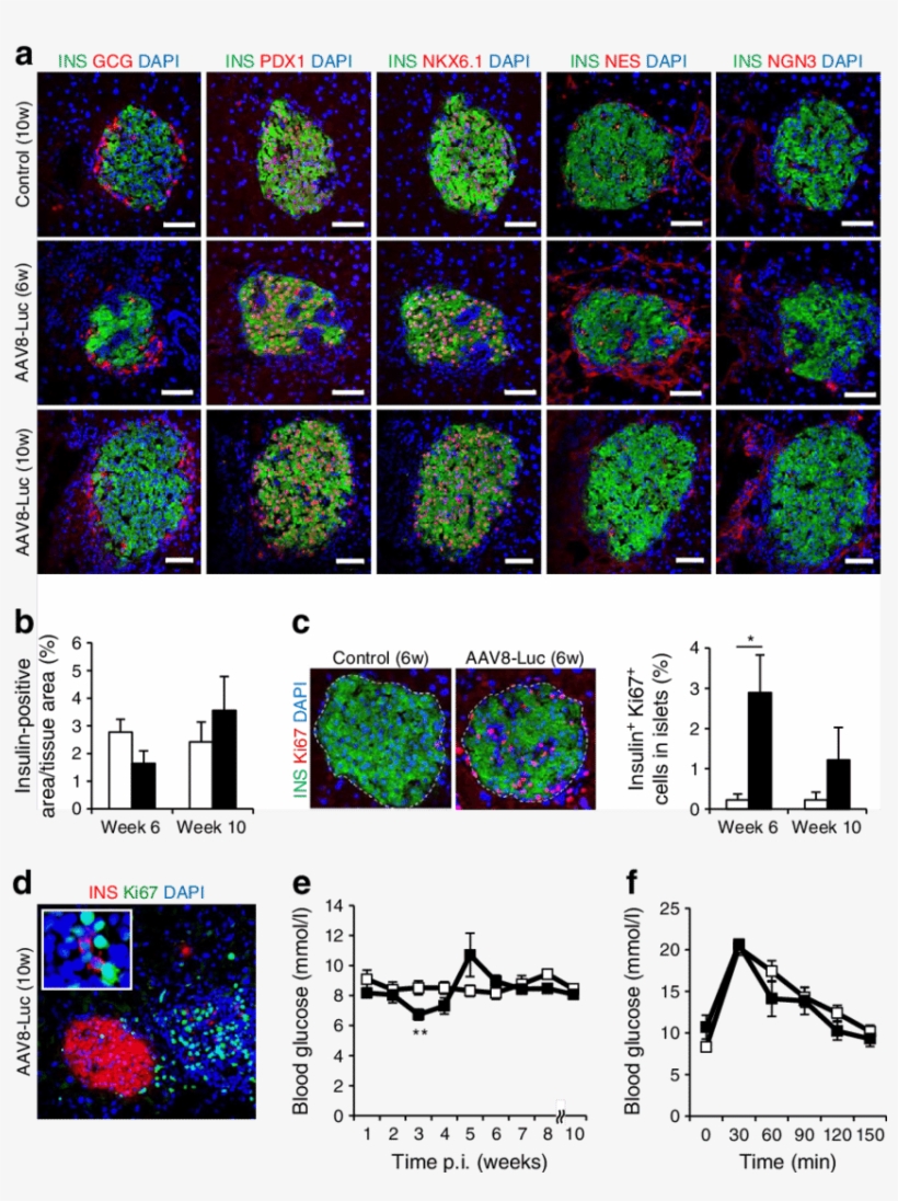 Induced Immunological Beta Cell Destruction Leads To - Diagram PNG ...