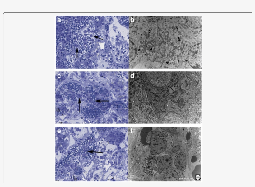 Ctcs In Three Cases Were Shown - Tile PNG Image | Transparent PNG Free ...