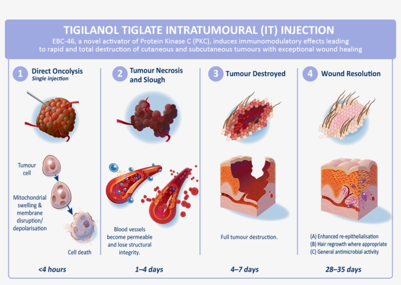 Ebc-46 Mode Of Action - Ebc 46 PNG Image | Transparent PNG Free ...