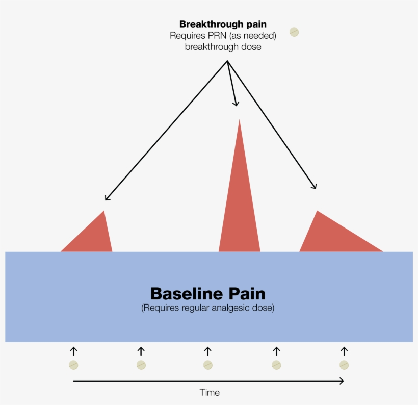 Breakthrough Pain - Diagram PNG Image | Transparent PNG Free Download ...