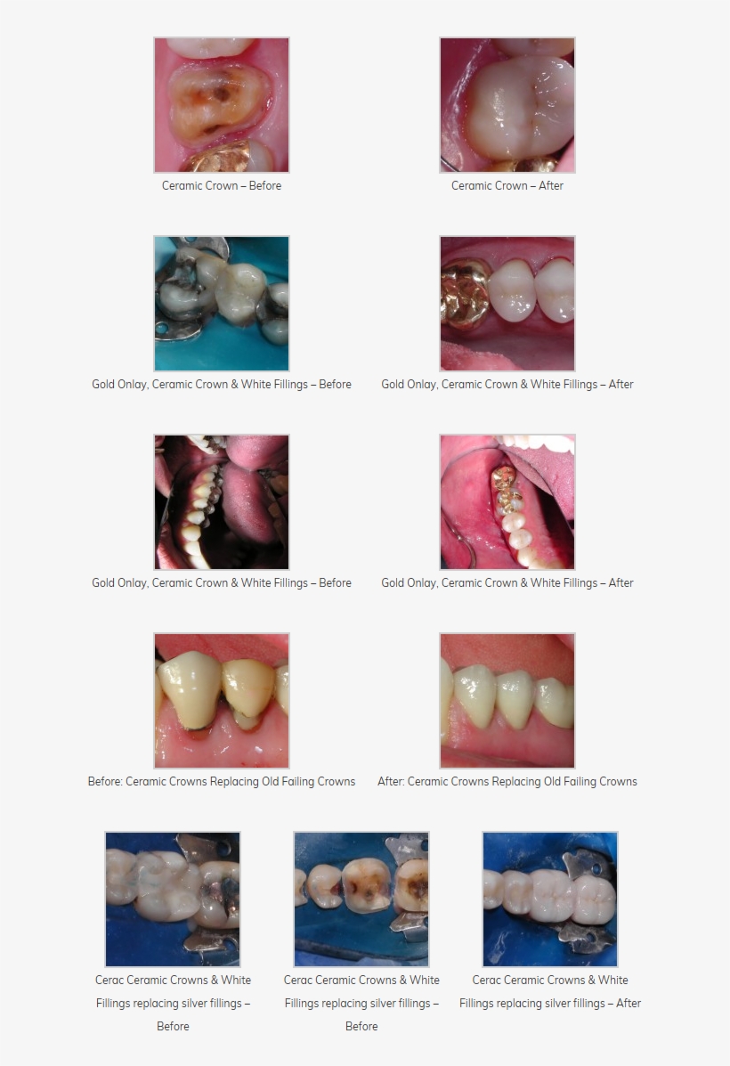 Minimally Invasive Procedure - Jaw PNG Image | Transparent PNG Free ...