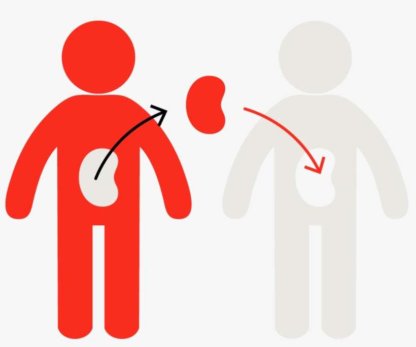 Donor Transparent Background - Organ Donation PNG Image | Transparent ...