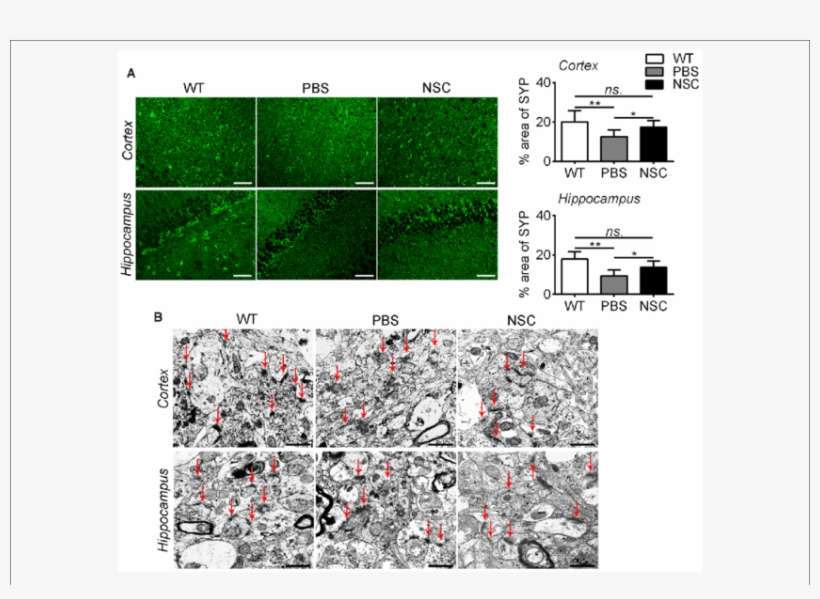 Syp Staining Sections In The Brains Of Pbs, Nsc Group - Grass PNG Image ...