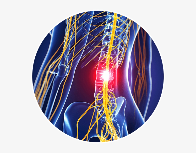 Real Patients - Pacientes Con Lesion Medular PNG Image | Transparent ...