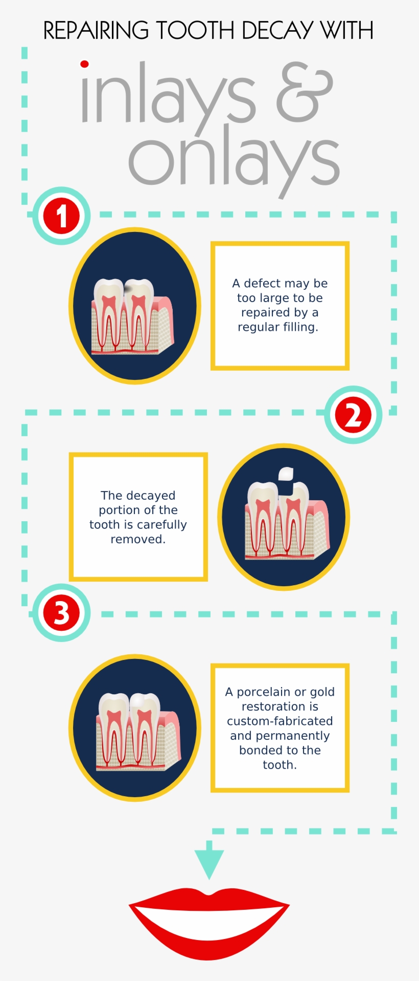 Download Inlay - Number | Transparent PNG Download | SeekPNG