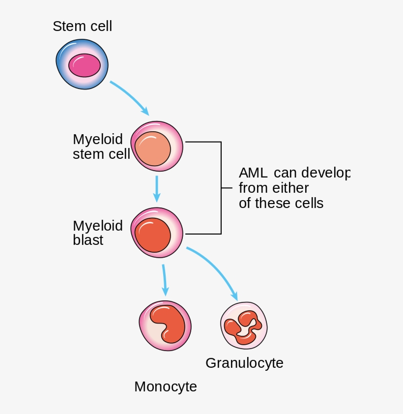 “diagram Showing The Cells In Which Aml Starts - Acute Myeloid Leukemia ...