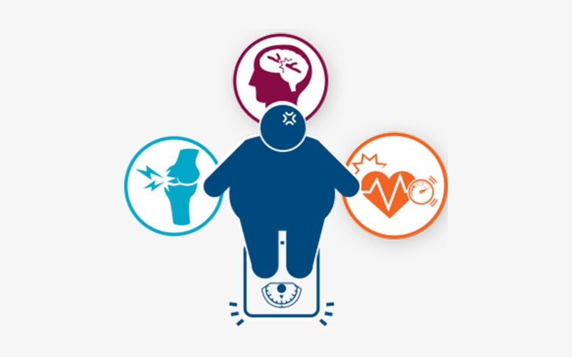 Download Metabolic Surgery - Obesity Png | Transparent PNG Download ...