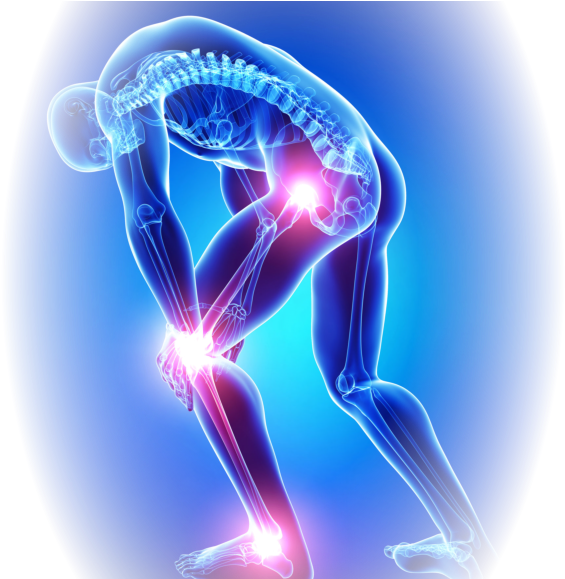Joint Pain - Knee Pain Images Png (631x578), Png Download