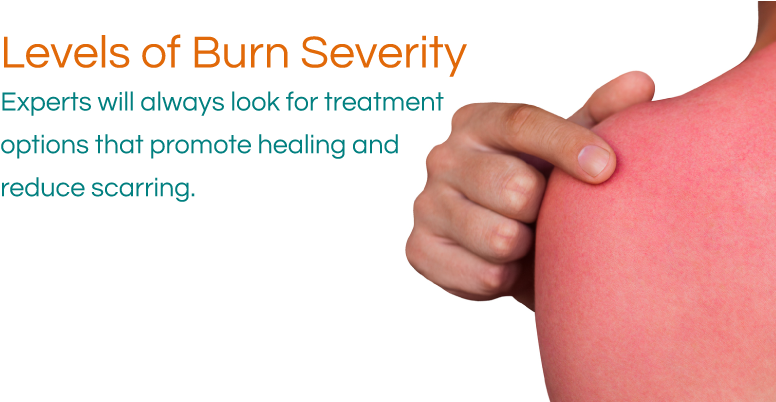 Levels Of Burn Severity - Sunburned Skin (801x401), Png Download